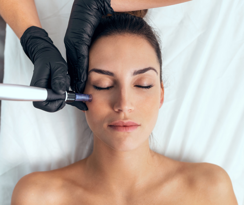 Everything you need to know about DermaPen for face | Kareema Issa ...